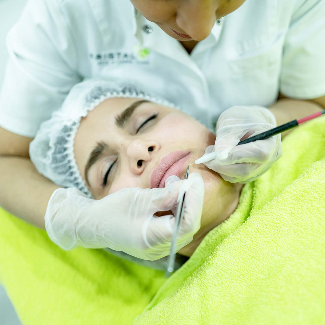 Afspraak maken? | Direct geholpen | Kristal Skin & Laser Clinic