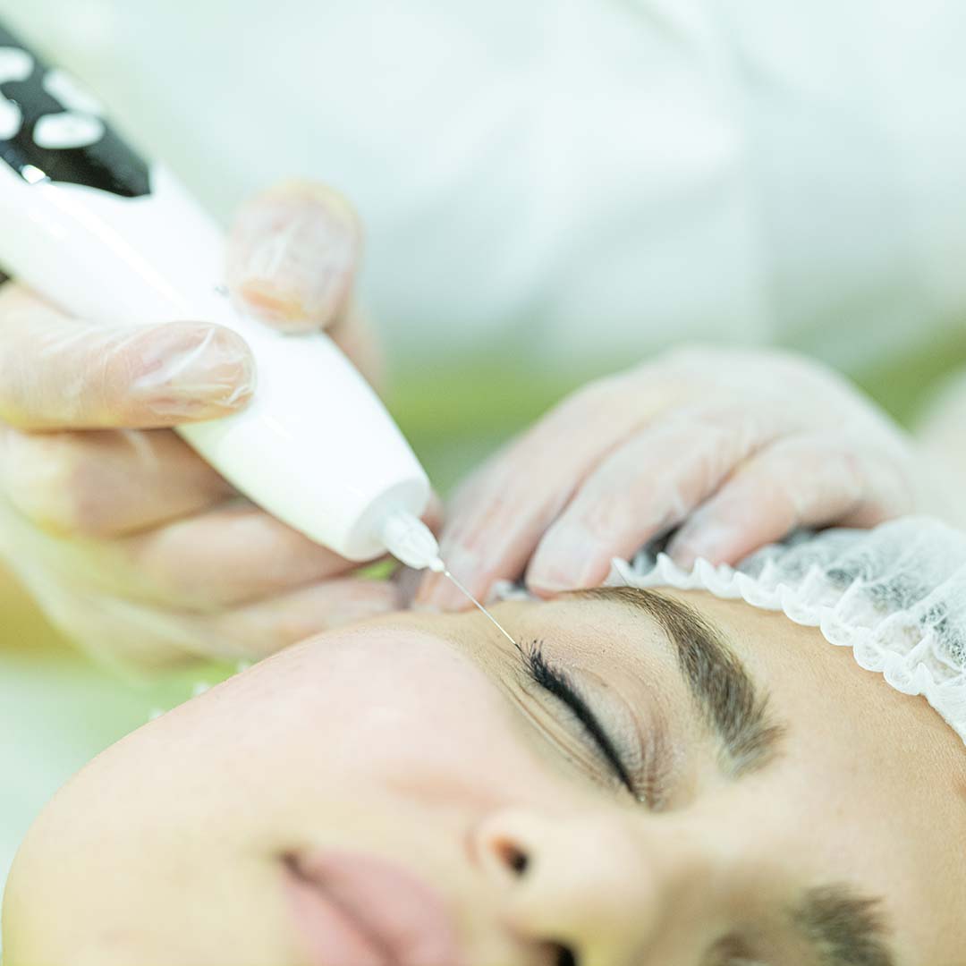 Veelgestelde vragen | FAQ | Kristal Skin & Laserclinic