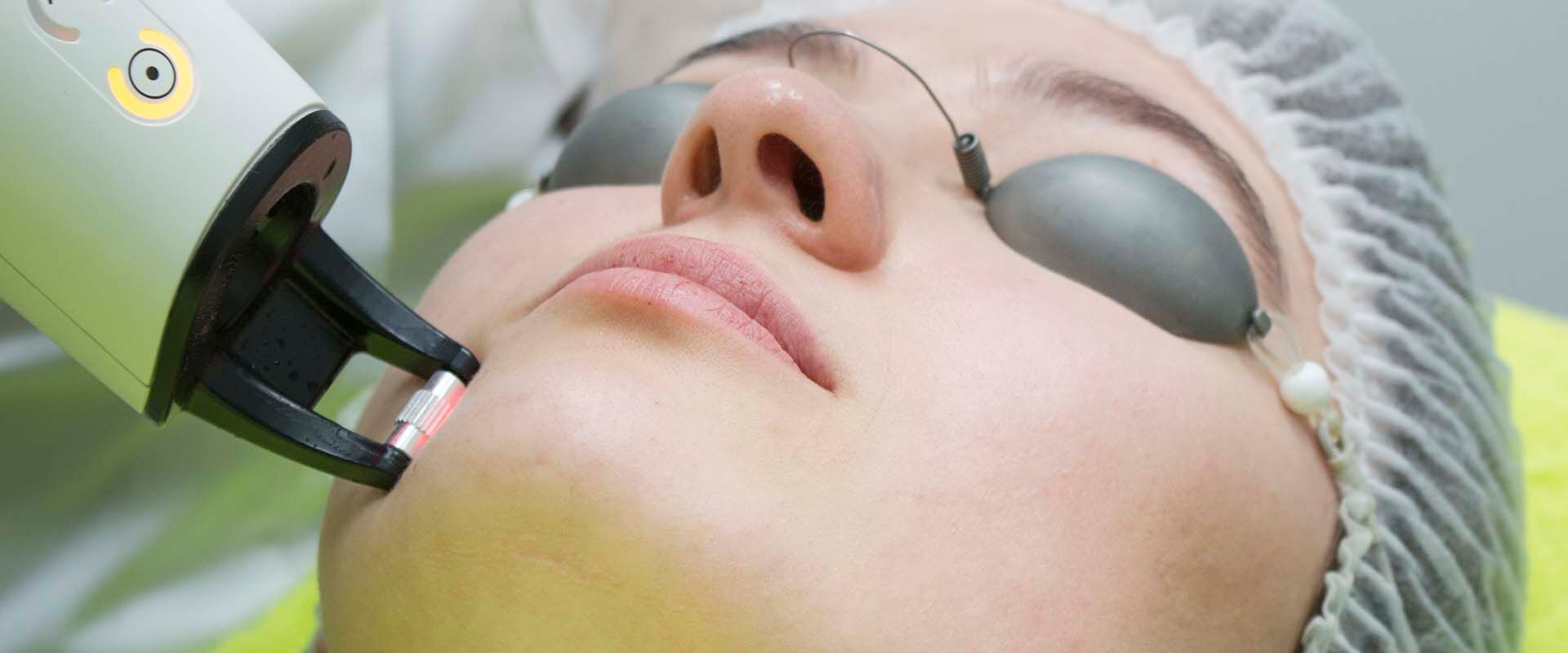 Fractional laser | Wat is het en hoe werkt het? | Kristal Skin & Laser ...